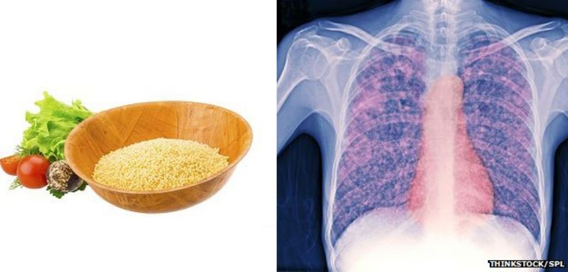 Medical meals: Using food to diagnose disease - BBC News