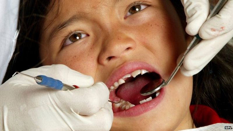 Dental charity blames bad baby teeth on 'child neglect' - BBC News