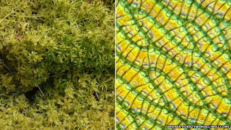 How Longshaw Lodge moss treated World War One injured - BBC News