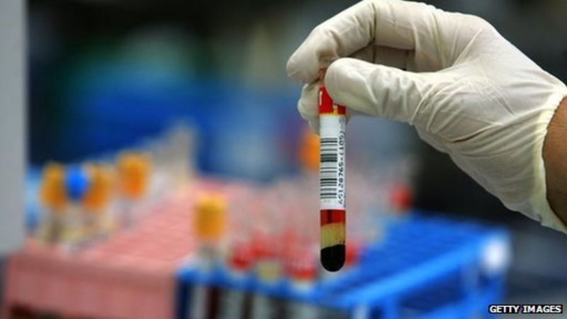 Blood diagnosis app 'can detect diseases' - BBC News
