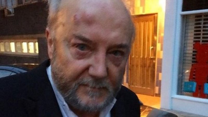 George Galloway leaves hospital after London street attack - BBC News