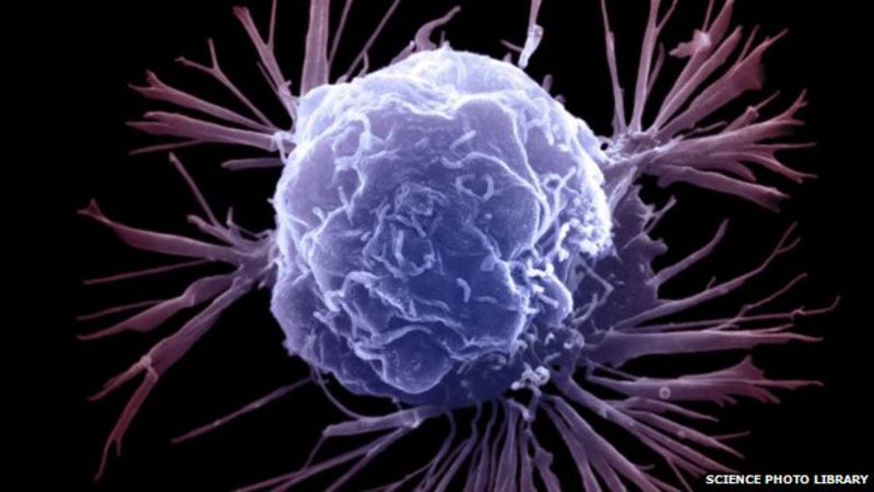 So is cancer mostly 'bad luck' or not? - BBC News