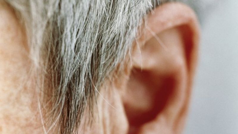 Skin may help spot Alzheimer's and Parkinson's disease - BBC News