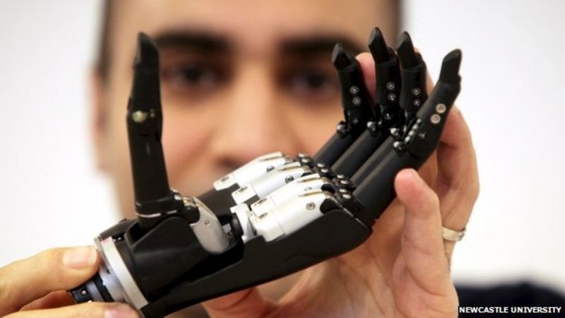 Newcastle University bionic limb project gets £1.4m boost - BBC News