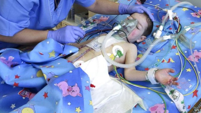 Child heart surgery deaths in UK 'halved' - BBC News