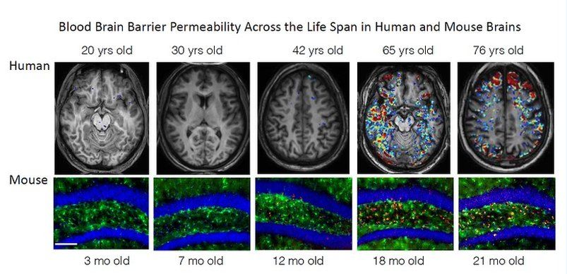 Chemicals 'repair damaged neurons in mice' - BBC News