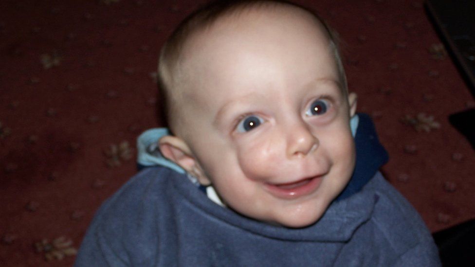 'They called me names like Scarface, Joker, Buttface' - BBC News