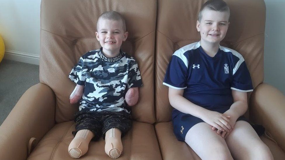 Luke Mortimer: Skipton boy who lost limbs to meningitis back home - BBC ...