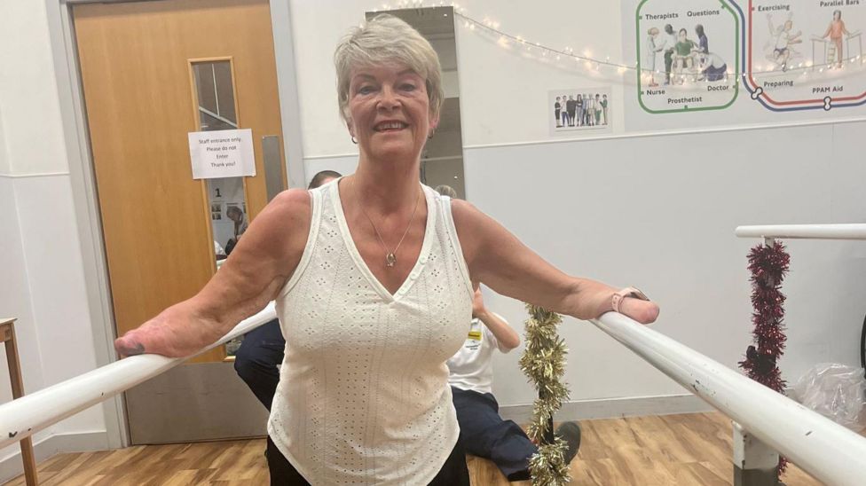 Amputee defies doctors by walking after five years - BBC News