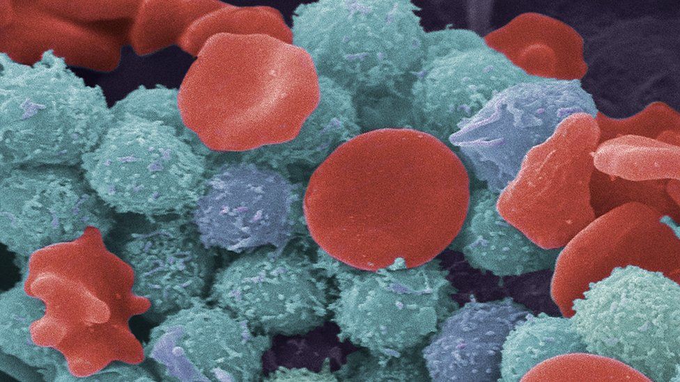 Cancer clusters at nuclear sites 'not linked to radiation' - BBC News