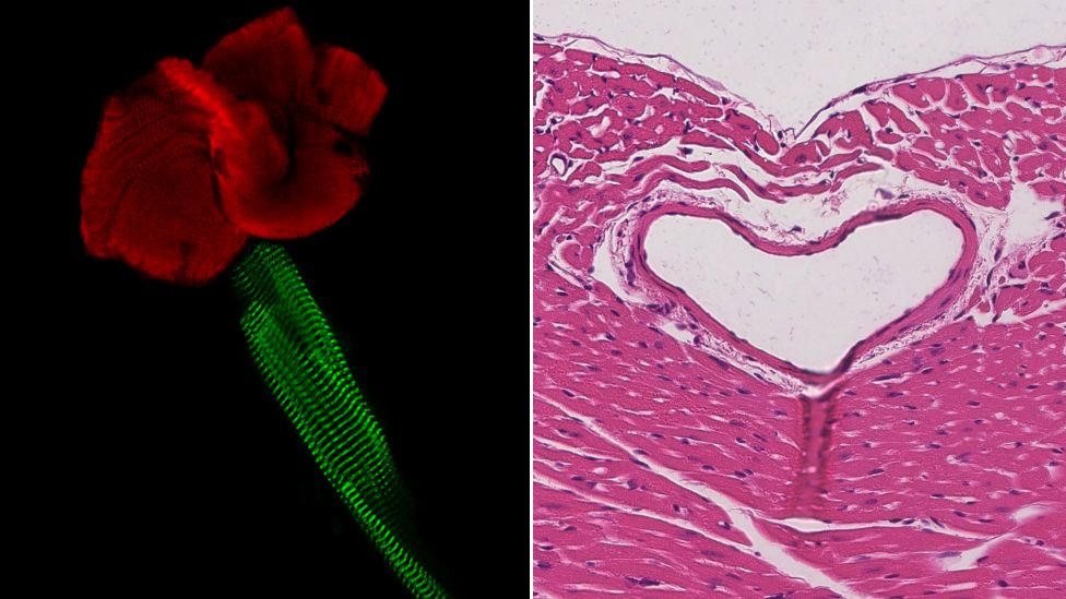 Heart-shaped red cell in blood clot photo wins competition - BBC News