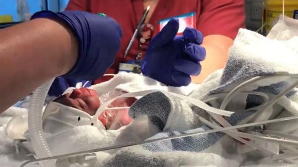 Babies died after London hospital's neglect - inquest jury - BBC News