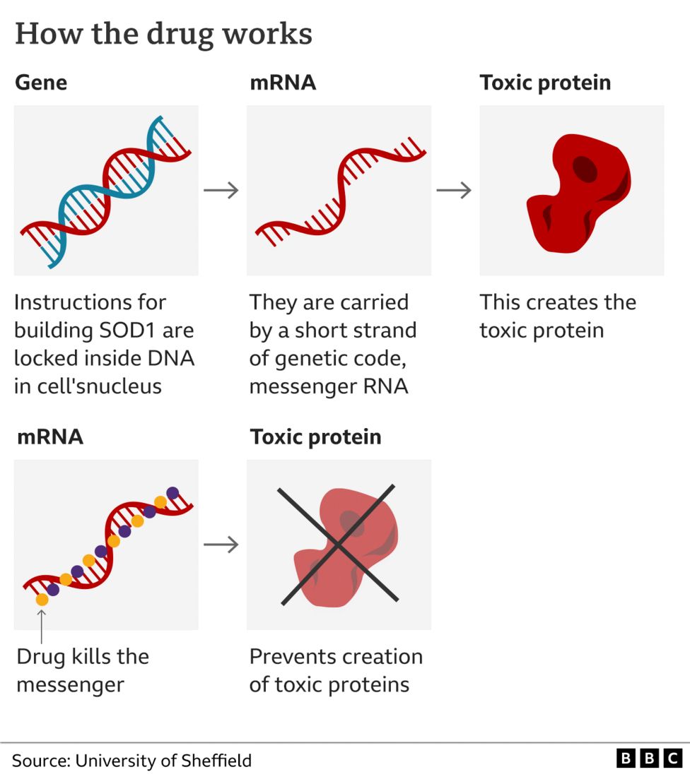 'Truly remarkable' drug helps motor neurone disease - BBC News