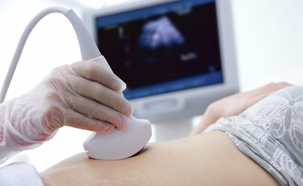 Viewpoint: 'Why I chose to have an abortion' - BBC News