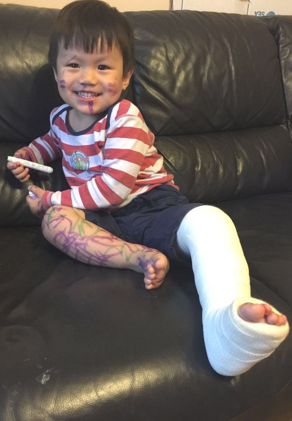 Injured boy's mother backs road safety campaign - BBC News