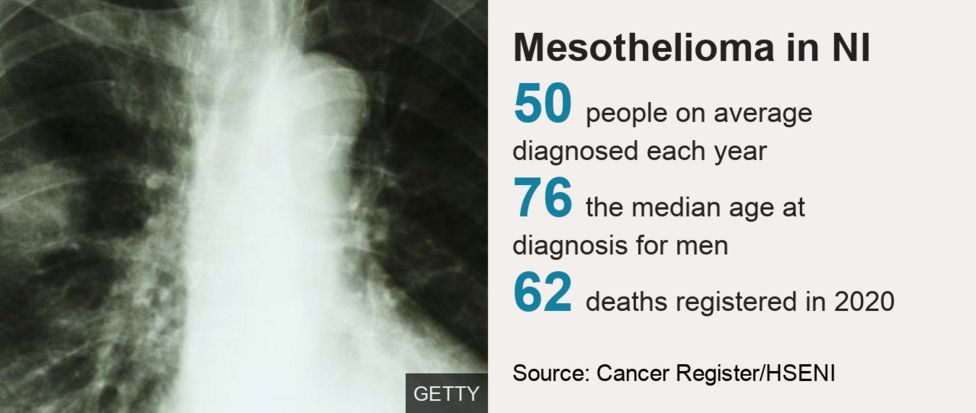 Asbestos: Calls for awareness over exposure-related deaths in Northern ...