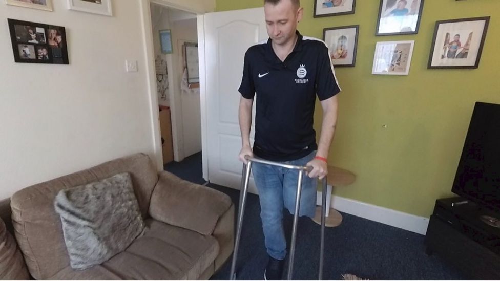 'Having my leg amputated will be like a Christmas gift' - BBC News