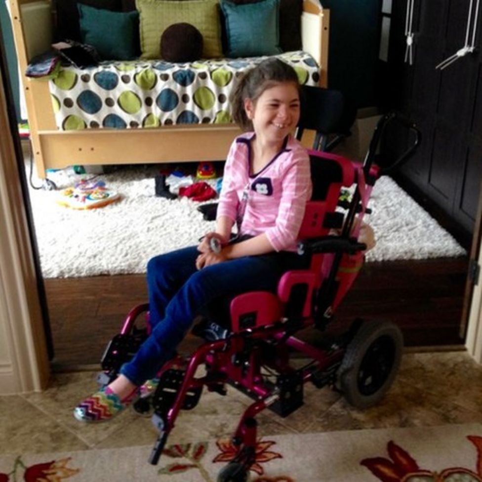 Microcephaly: 'It's not the end of the world' - BBC News