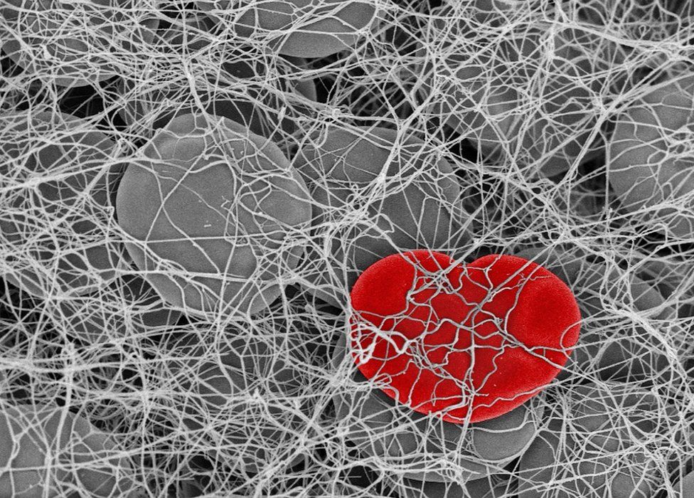 Heart-shaped red cell in blood clot photo wins competition - BBC News