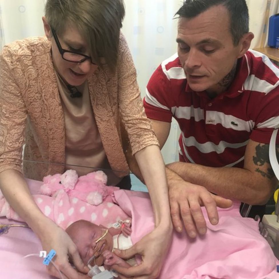 Baby born with heart outside body 'doing well' - BBC News
