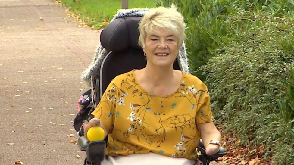 Sepsis: 'My life changed eight years ago on Christmas Eve' - BBC News