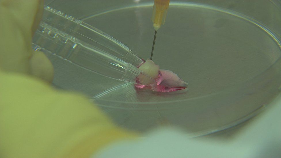 Commercial harvesting of stem cells under way - BBC News