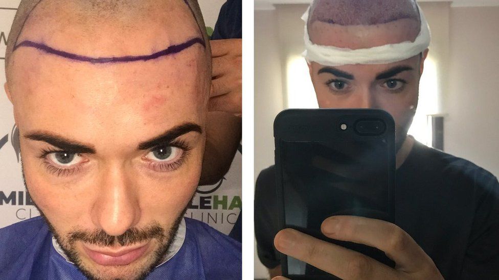 Y 'gyfrinach' newidiodd byd Iwan Steffan - BBC Cymru Fyw