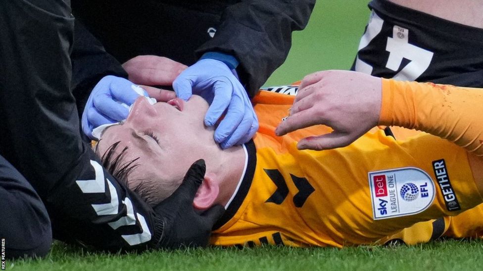 Steve Seddon: Cambridge loan signing has surgery for serious facial ...