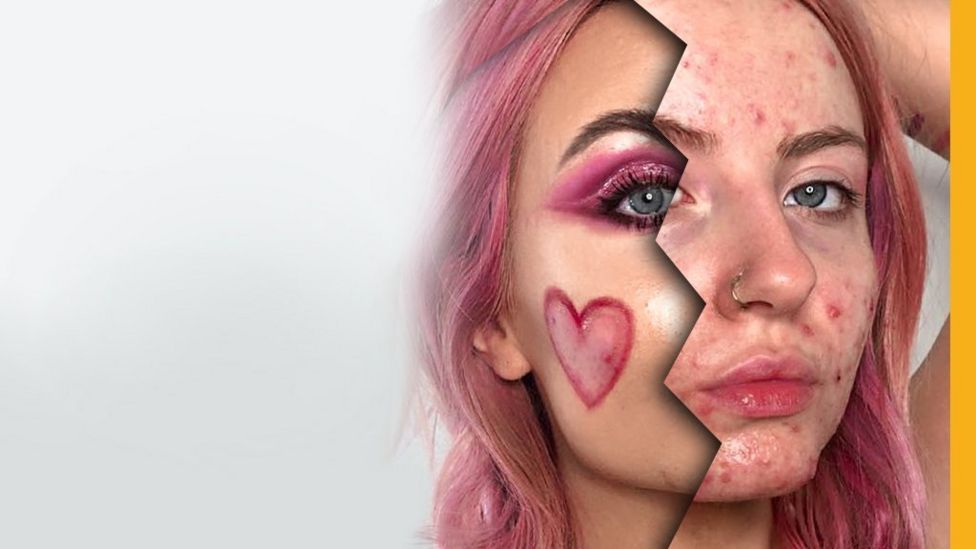 Instagram: From boy bullied for acne to beauty guru - BBC News