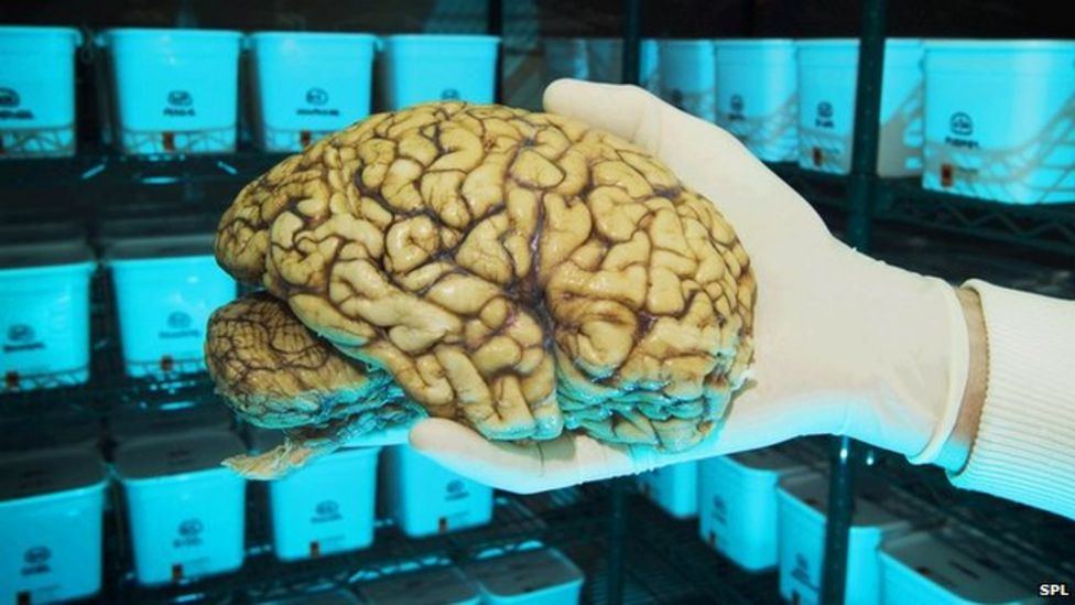 Peeking into the brain's filing system - BBC News