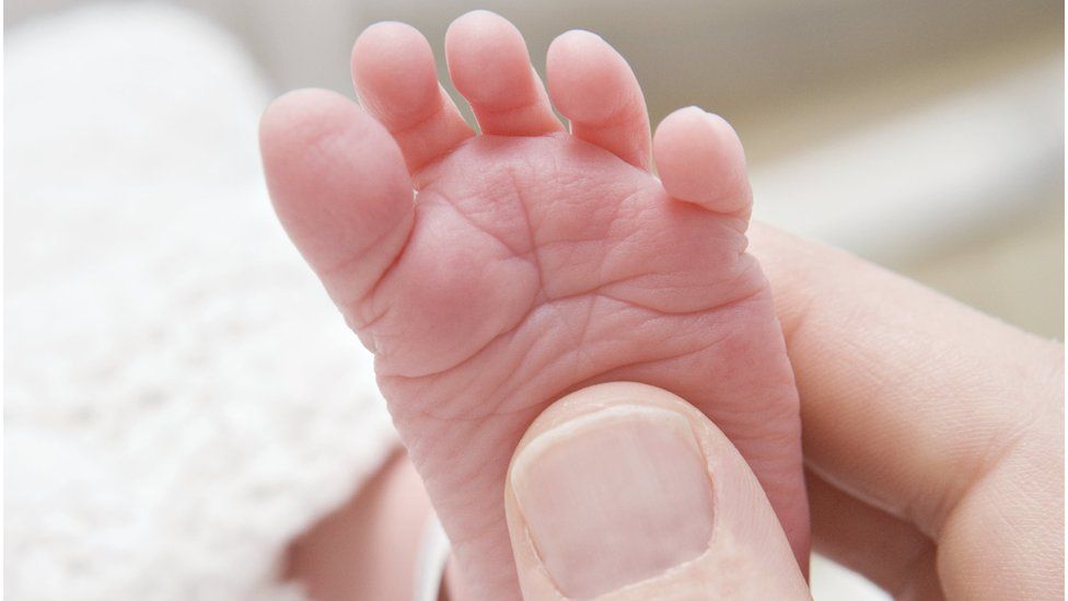 New birth injuries compensation scheme announced - BBC News