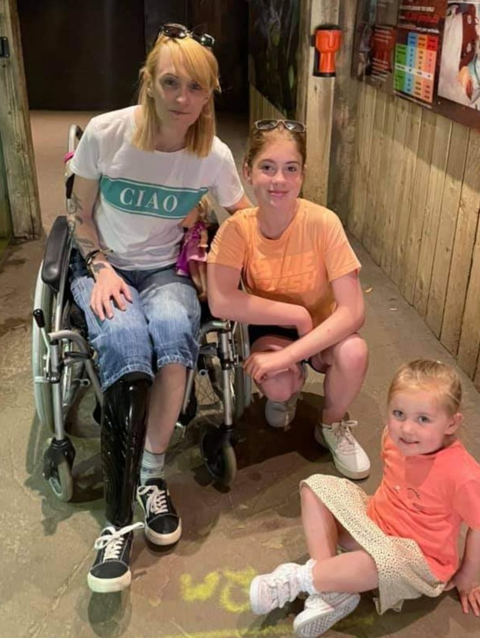 Amputees want more help for limb loss mental anguish - BBC News