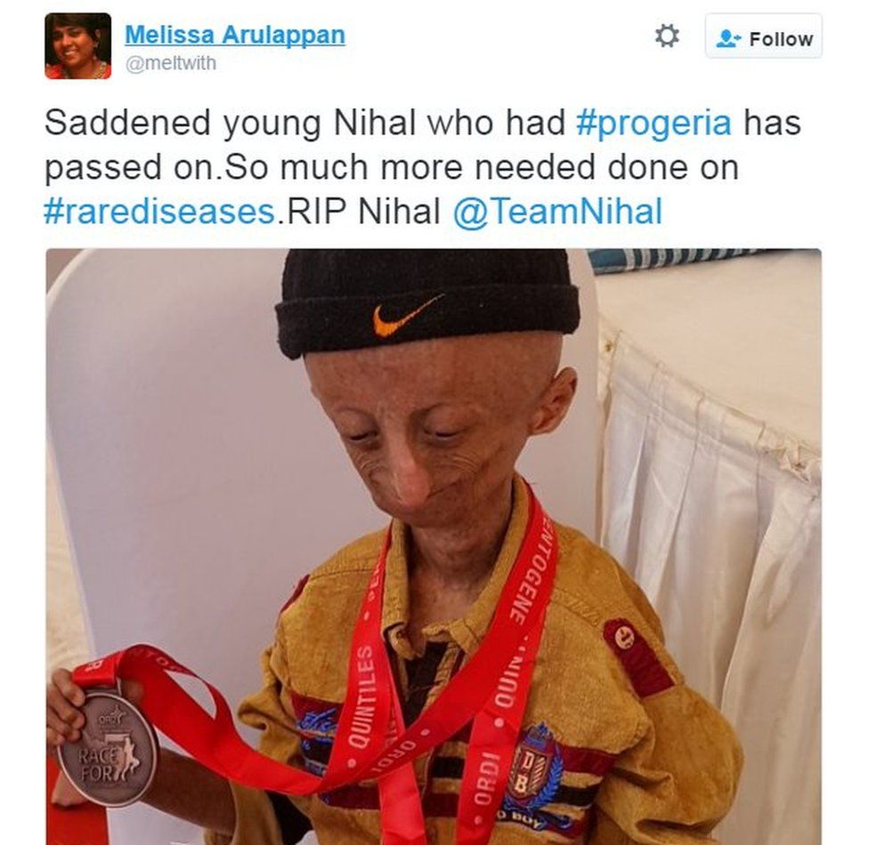 Nihal Bitla: India progeria campaigner dies aged 15 - BBC News