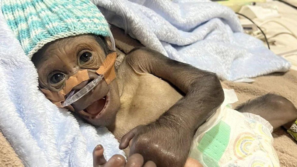Wildlife: Doctors save 10-day-old baby gorilla with care normally given ...