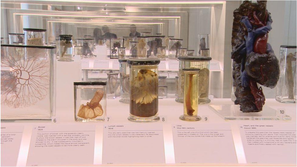 Edinburgh's Surgeons' Hall Museums reopens after £4m revamp - BBC News