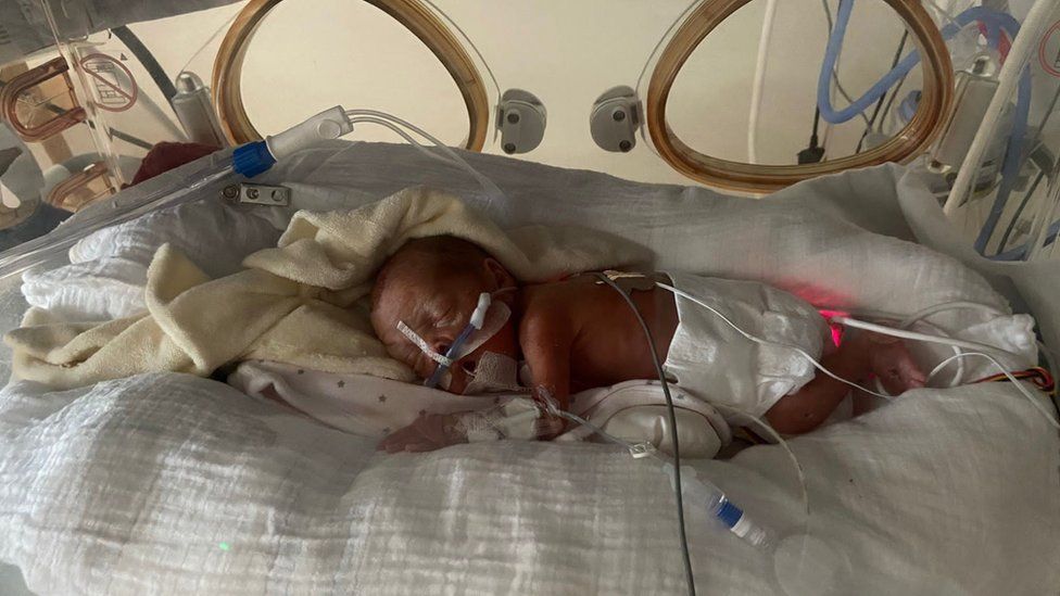 Peterborough family celebrates baby Luca with charity walk - BBC News