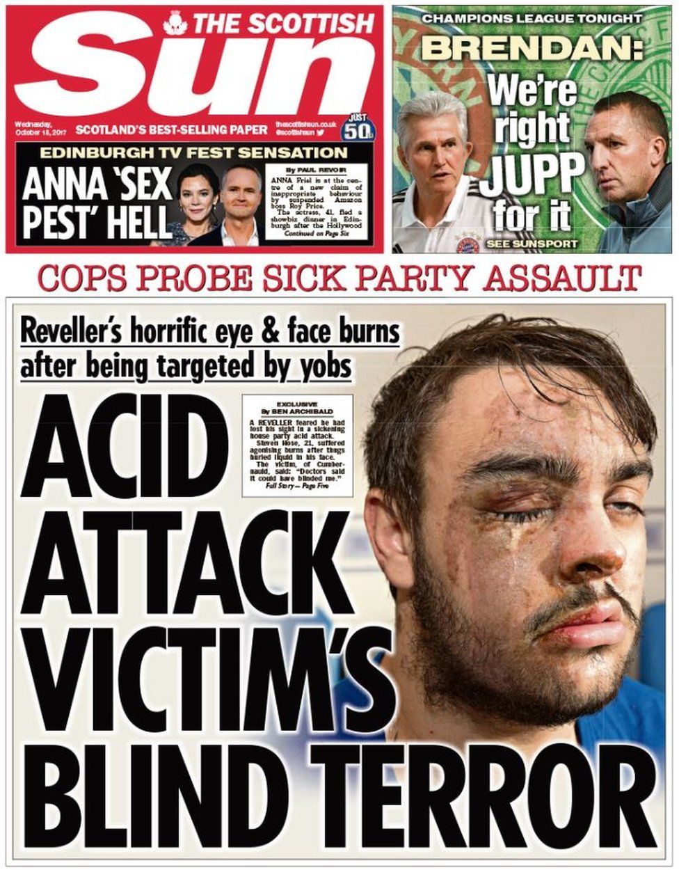Scotland's papers: Party 'acid' attack probe - BBC News