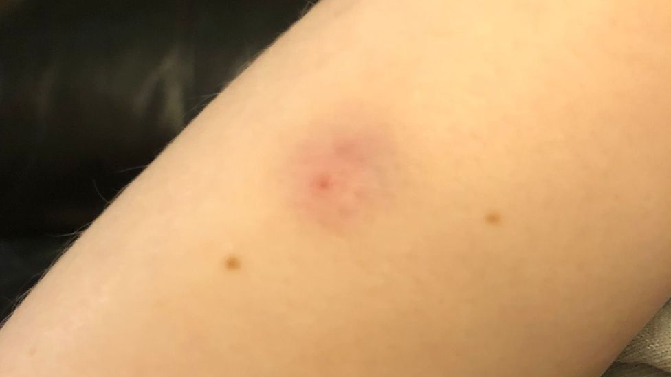 Injection spiking: UEA student says experience left her scared and ...