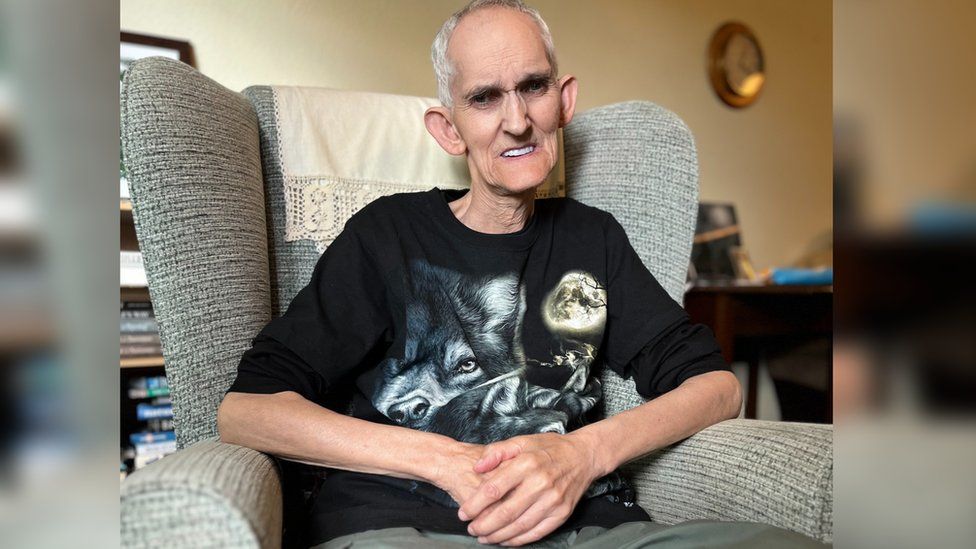 NHS at 75: Shared birthdate patient tells of a lifetime of care - BBC News