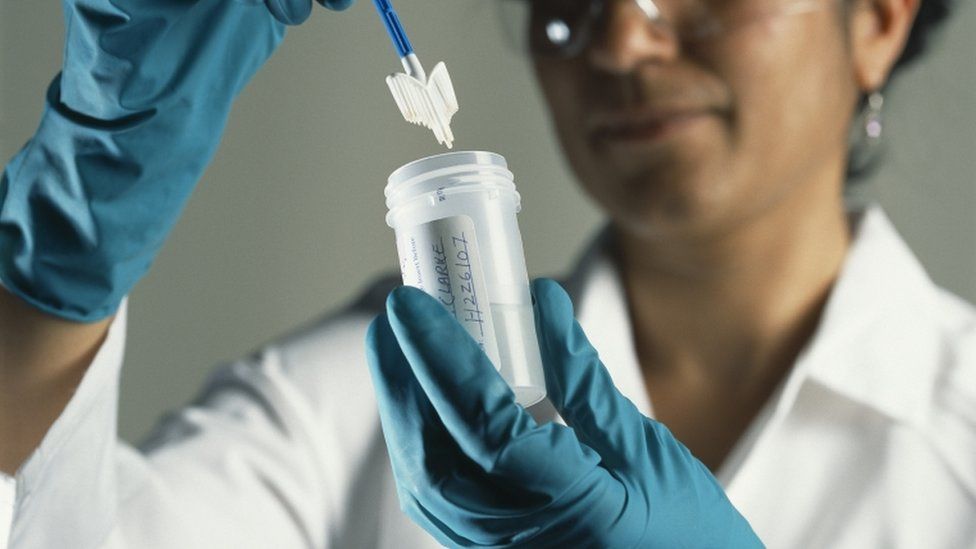 Up to 55,000 smear re-tests in Essex may be needed - BBC News