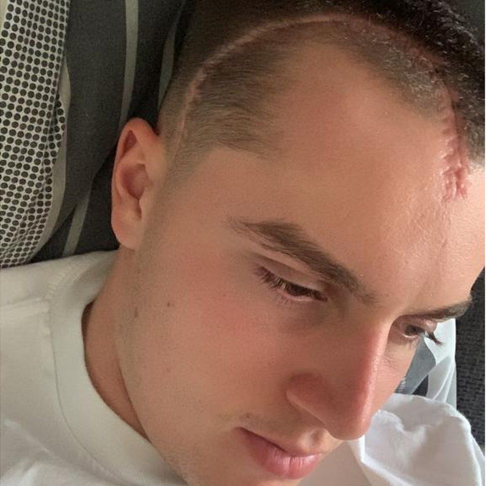 Magaluf: Cardiff man says Majorca bouncer almost killed him - BBC News