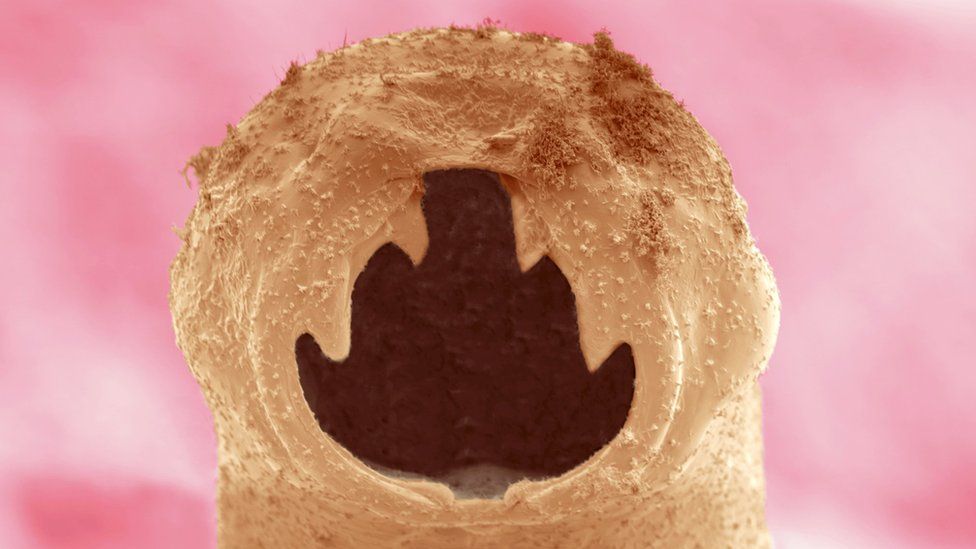 Parasitic worm 'increases women's fertility' - BBC News