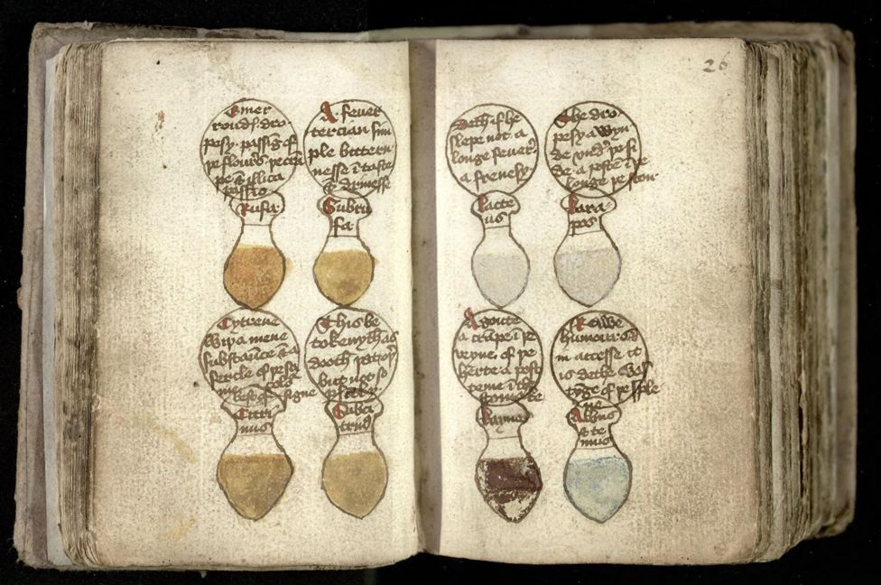 Check out these gruesome medieval treatments! - BBC Newsround