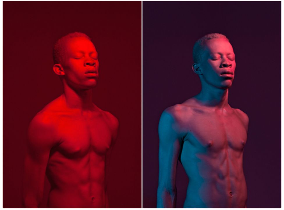 In pictures: Albinism and perceptions of beauty - BBC News