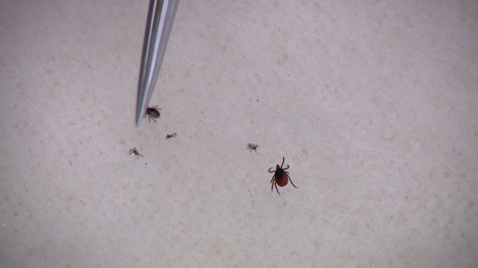 Woman bedridden for two years by Lyme disease from tick bite - BBC News