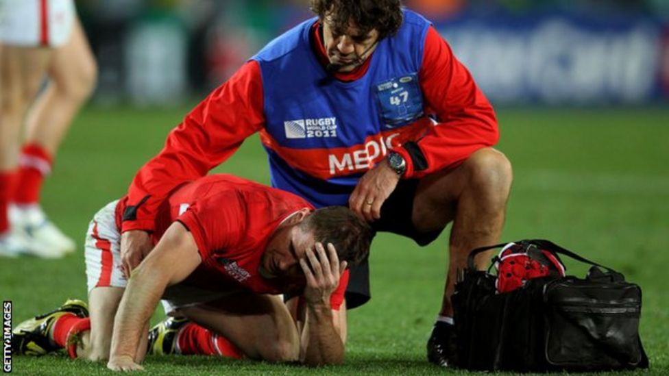 Rugby: Head impact study says players' cognitive function can decline ...