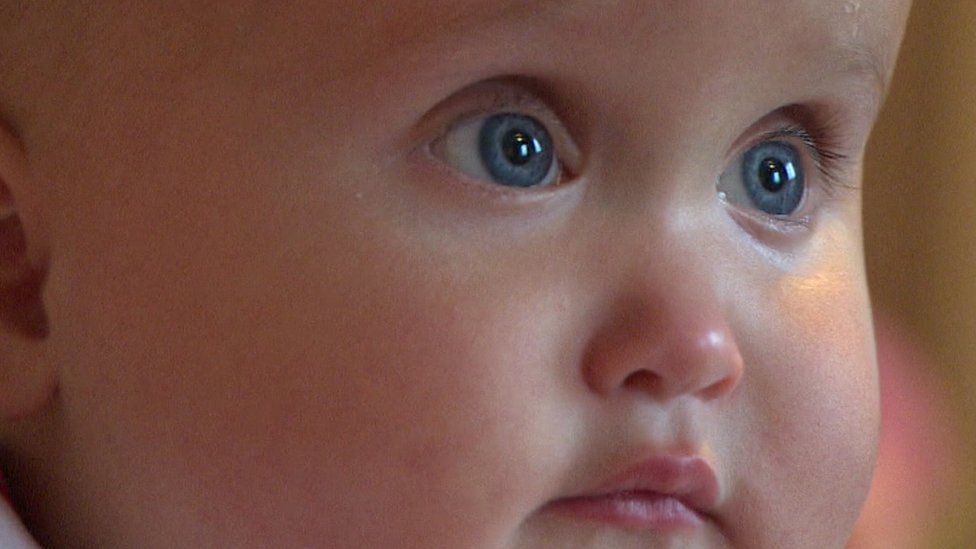 Womb operation baby makes 'astonishing' progress - BBC News