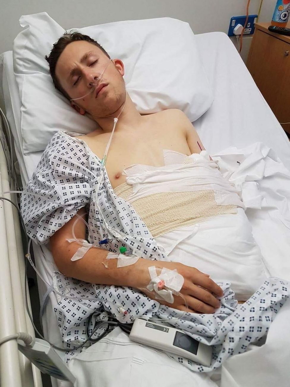 Firefighter returns to dream job after hand injury - BBC News