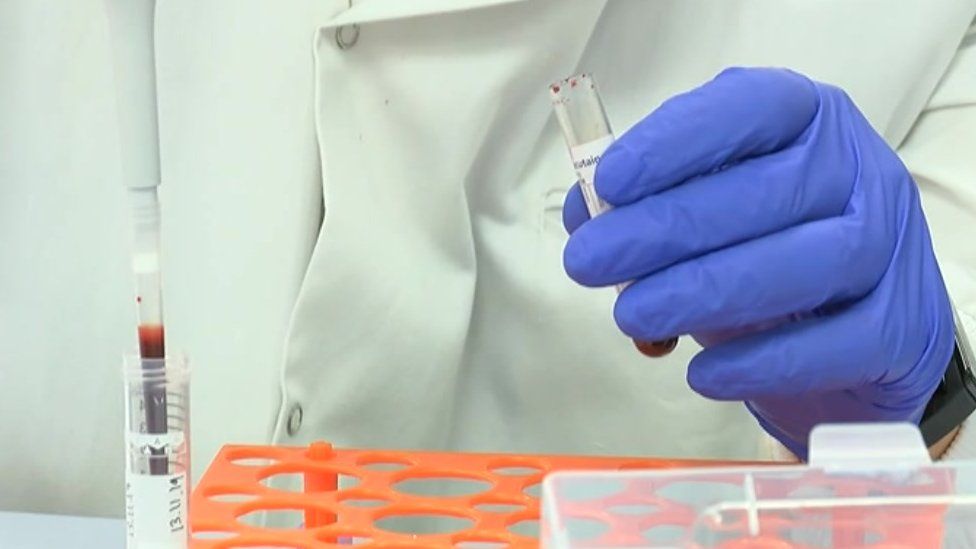 University of Brighton: Breakthrough anti-doping test developed - BBC News