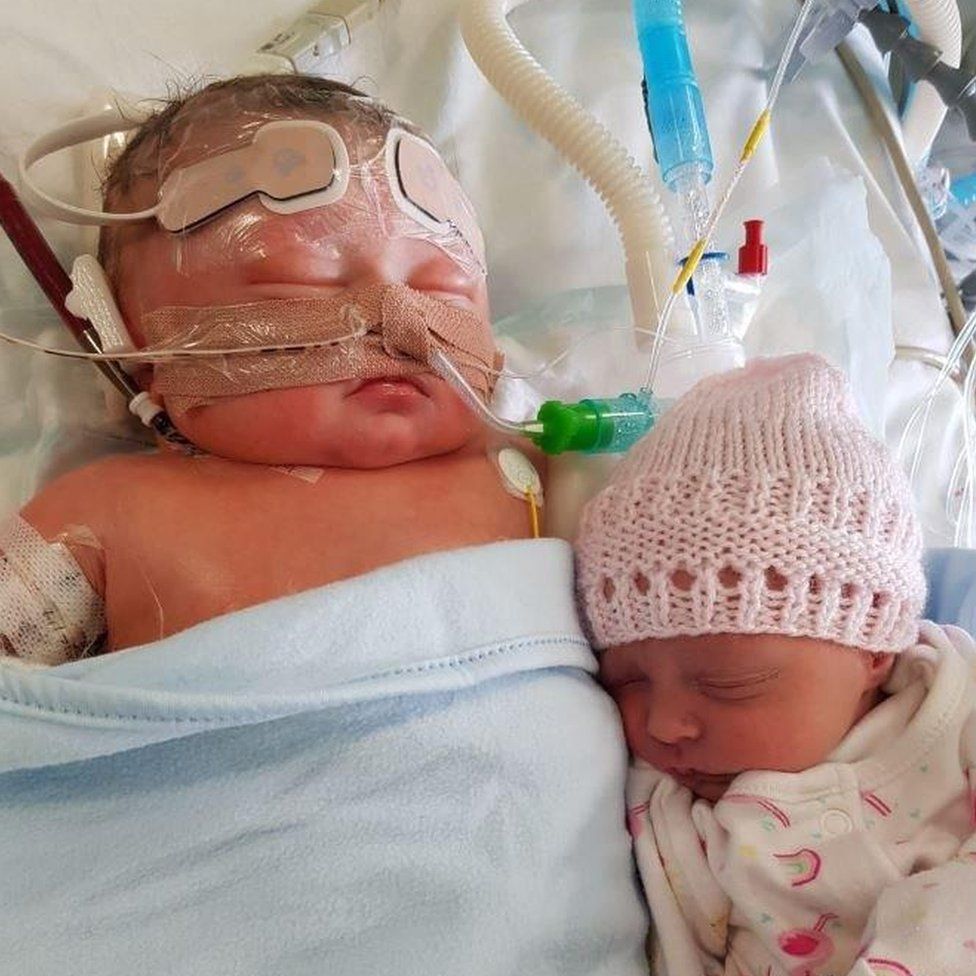 East Kent hospitals: Baby death parents’ heartbreak over errors - BBC News